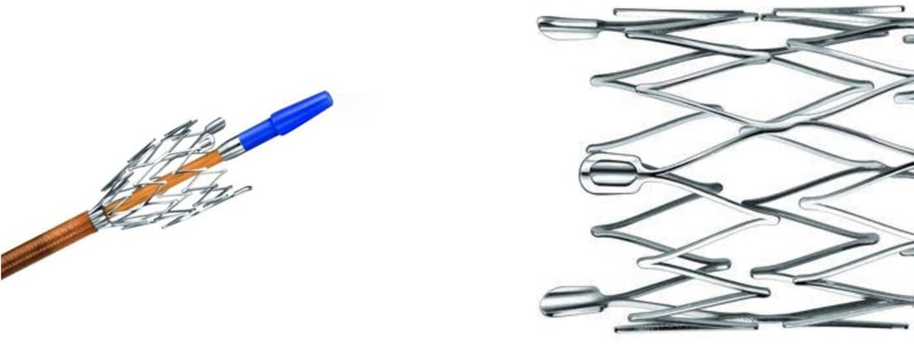 DexStent-UN Nitinol Urethra Stent | Dextronix, Inc.